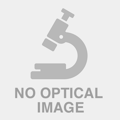 METASPACE annotation platform